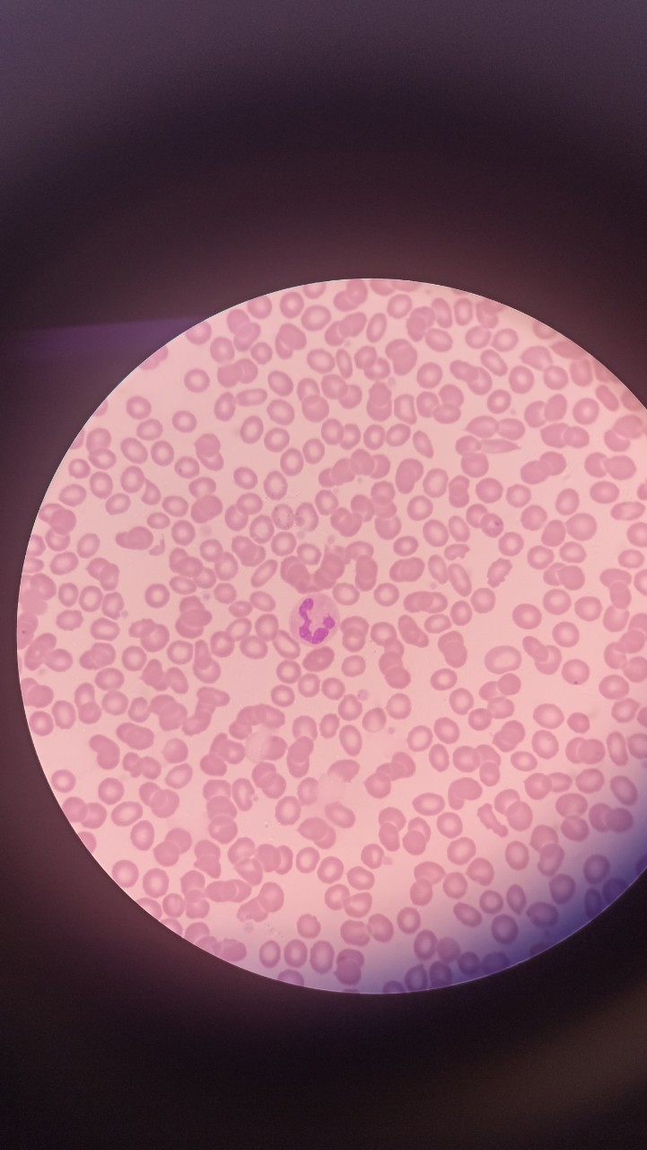 WBC Object Detection Dataset by Top