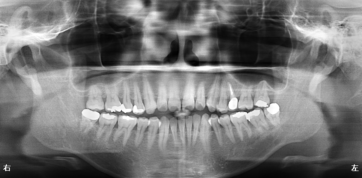 yosshi - Roboflow Universe