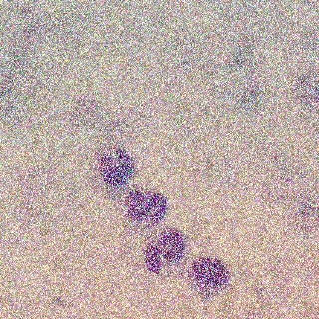 Noisy Malaria Cell Dataset Object Detection Dataset By Engbenard