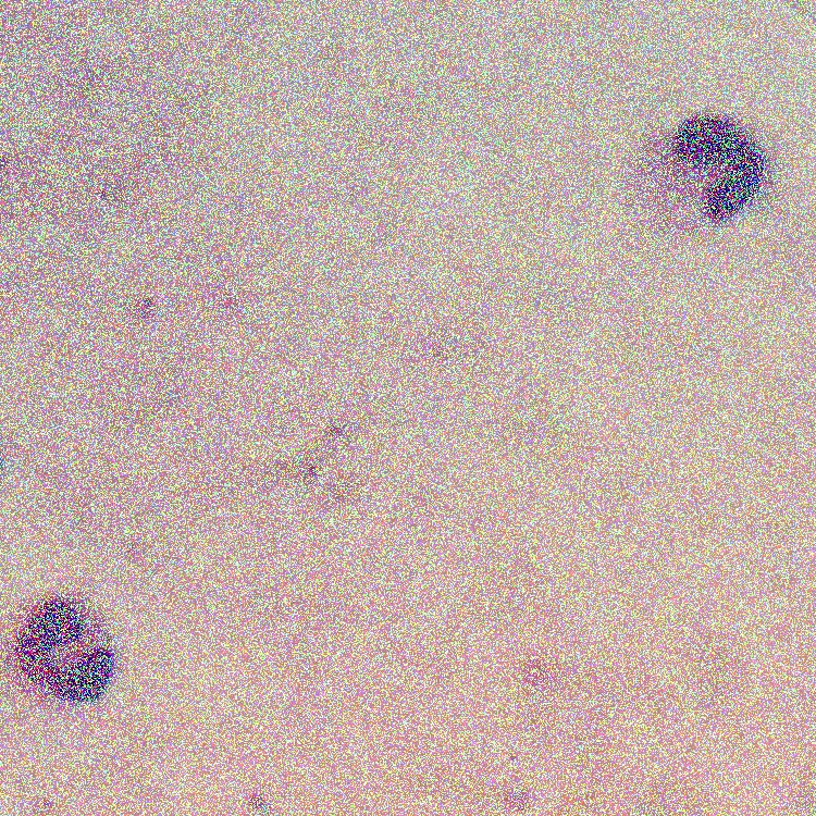 'Parasitized Malaria Cells' Object Detection Dataset by engbenard