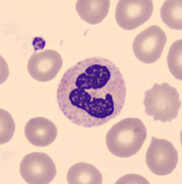 blood cell detection Object Detection Dataset (v1, rbc and platelet) by ...