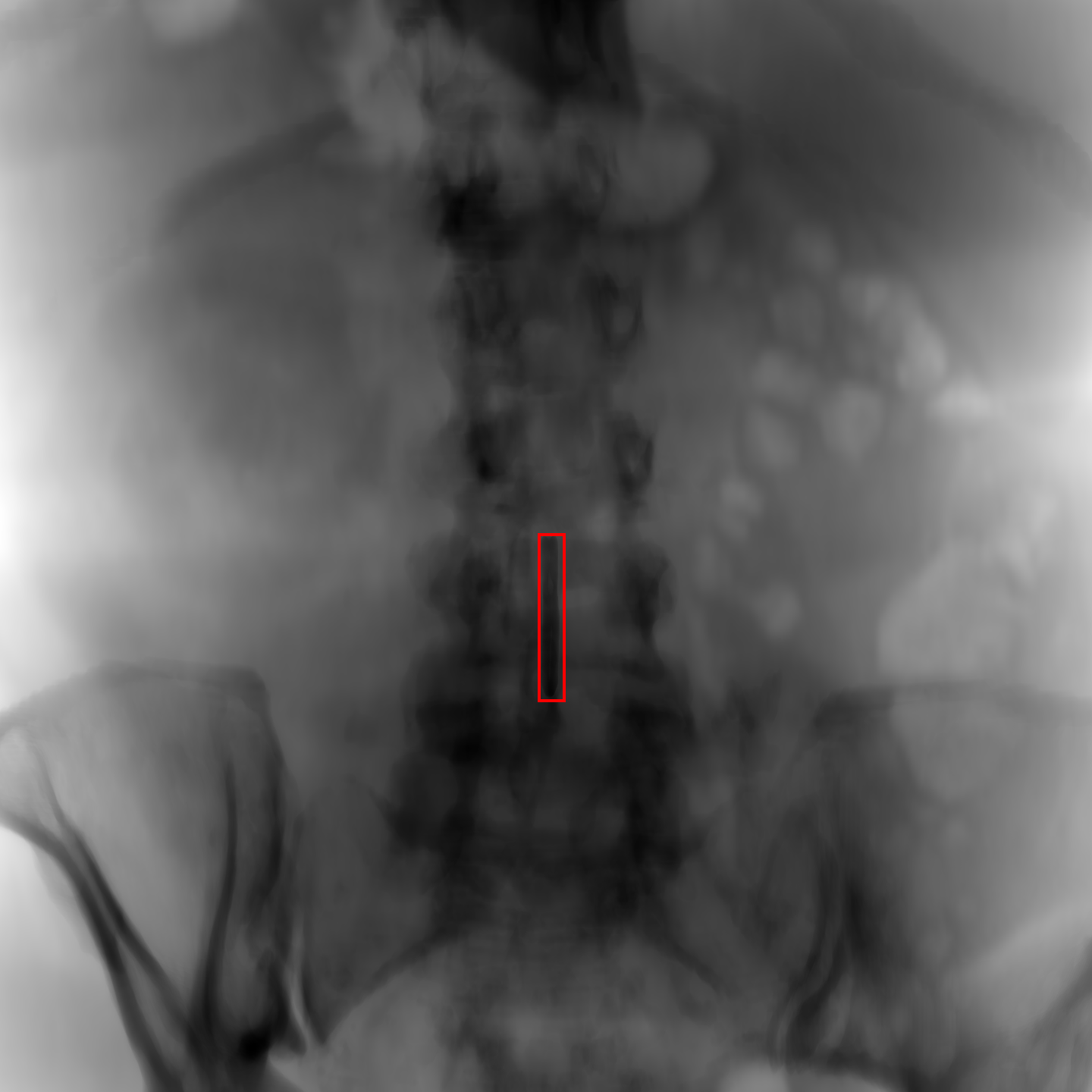 EVAR Object Detection Dataset (v1, 2023-03-21 2:17pm) by TUM