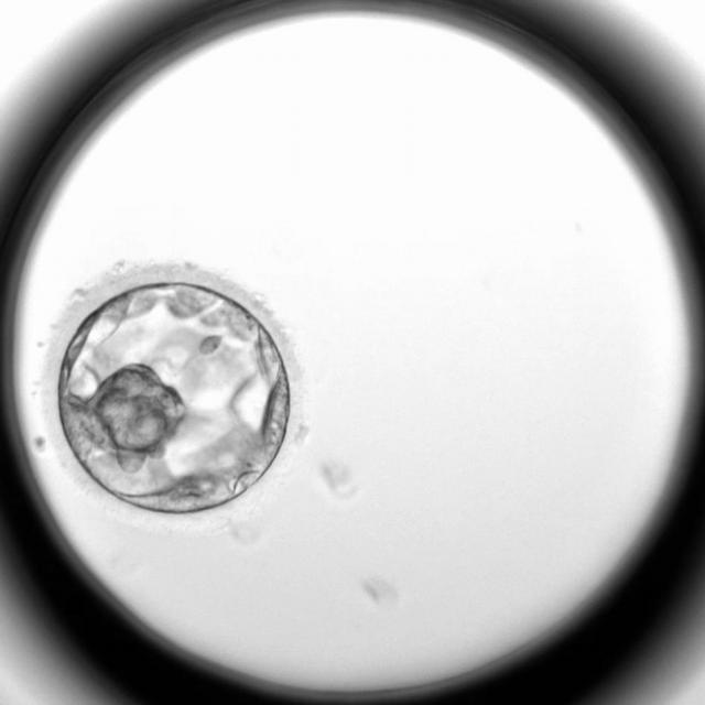 oocyte (oocyte-7lgtq) - Roboflow Universe