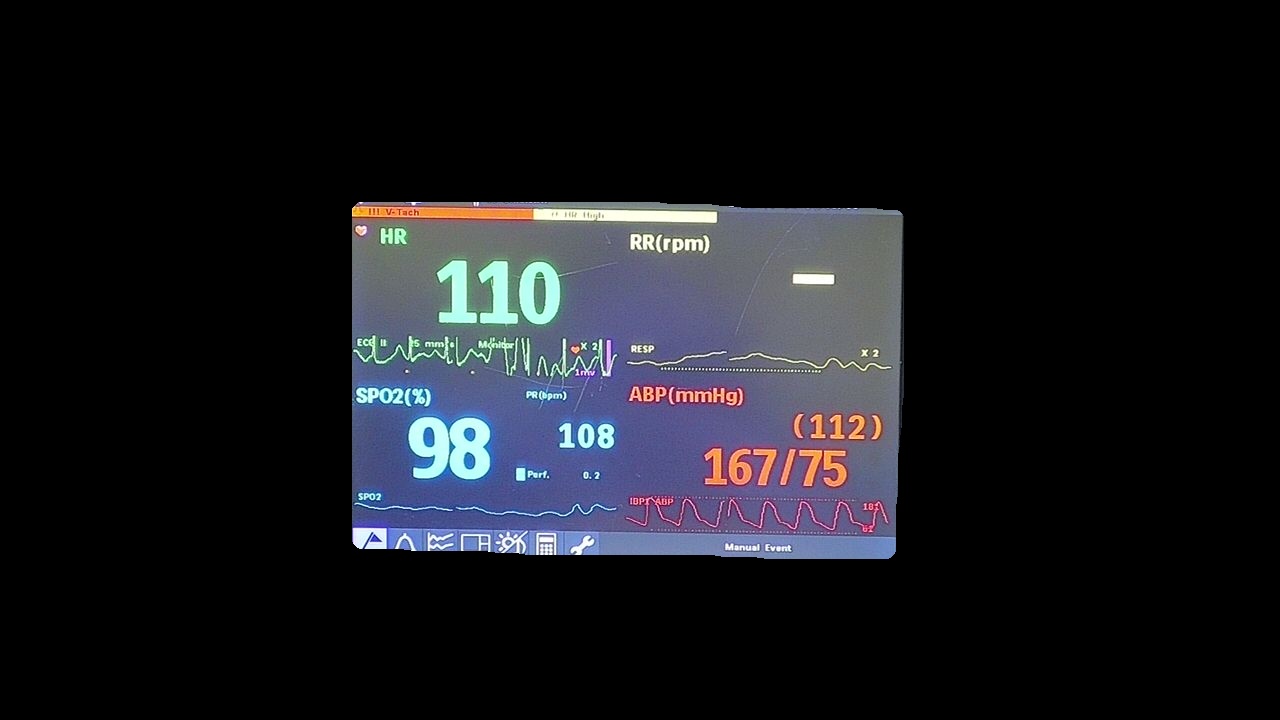 Number-detection(Mon1) Object Detection Dataset and Pre-Trained Model by KingAJ