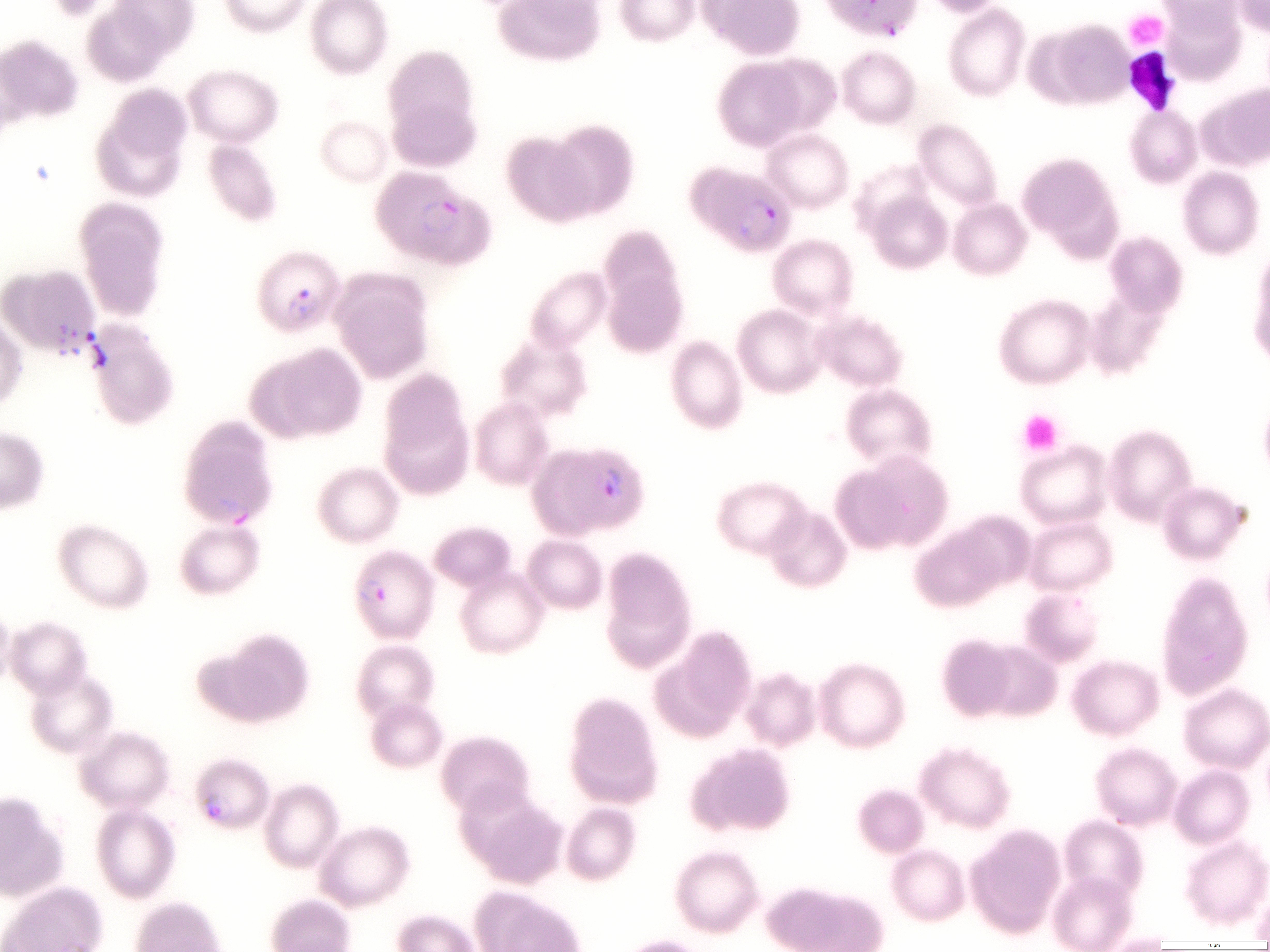 Malaria Object Detection Dataset By Koon Cholpatan