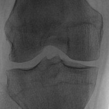knee Instance Segmentation Dataset by Drjo