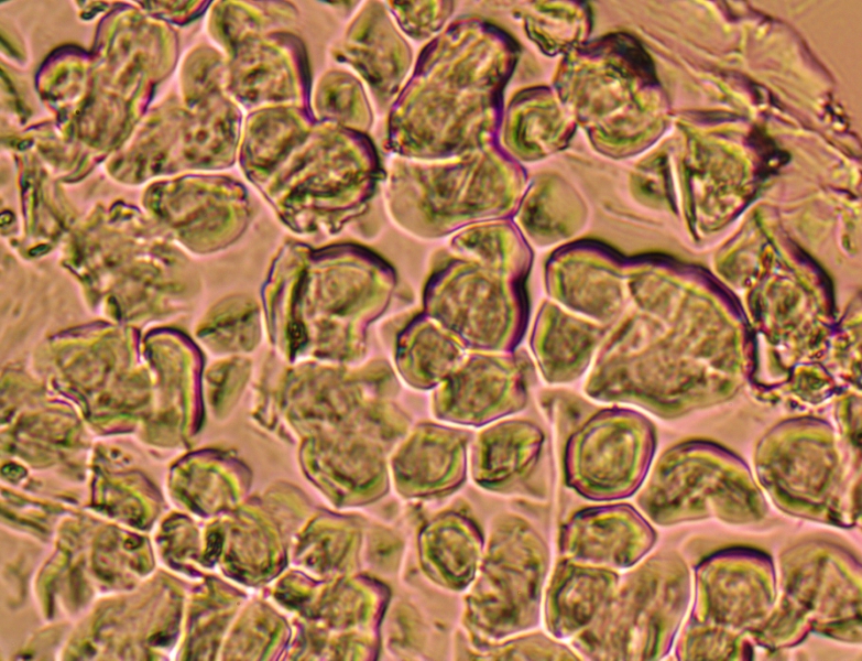 Lung Cancer Object Detection Dataset by Biophotonics Cancer Detection