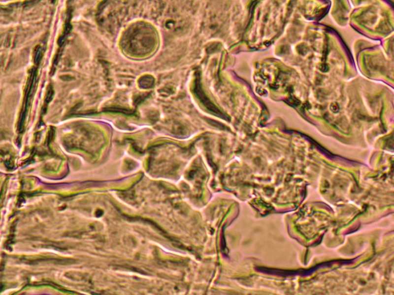 Kidney cancer Object Detection Dataset by Biophotonics Cancer Detection