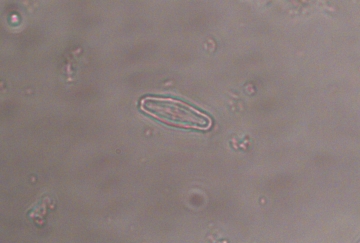 Plankton_01 Object Detection Dataset and Pre-Trained Model by Eawag