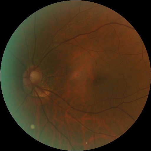 eye diseases Classification Dataset by indian servers
