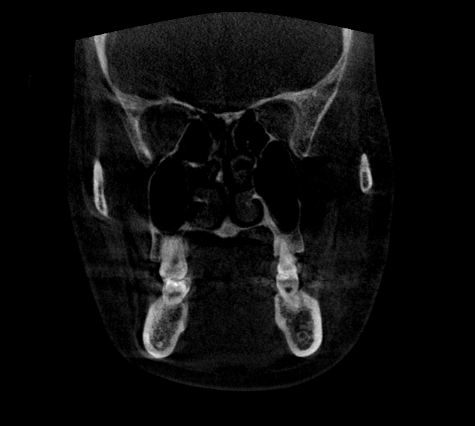 Osd Test 1 Object Detection Dataset And Pre Trained Model By Osd Project