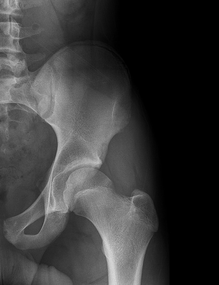 AI Hip Object Detection Dataset by Medical School