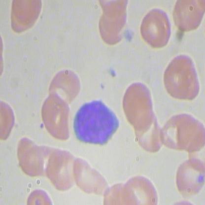 bccd-yolov5 Object Detection Dataset by personal