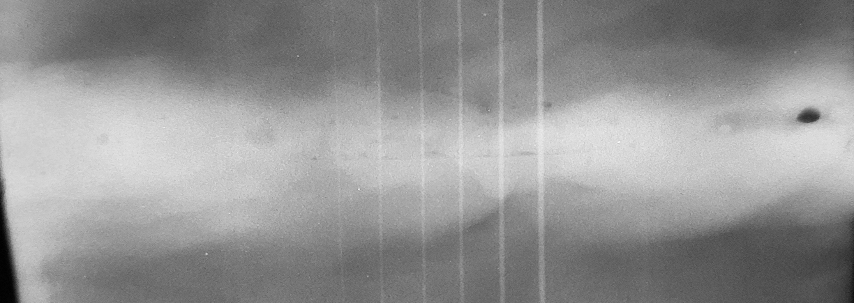 Xray Object Detection Dataset By New Workspace 89n5k