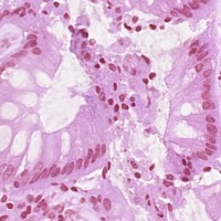 Conic-YOLOv5 Object Detection Dataset and Pre-Trained Model by SoftSensor AI