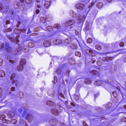 Monusac-YOLOv5 Object Detection Dataset and Pre-Trained Model by SoftSensor AI