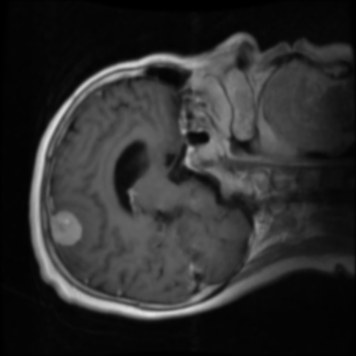 gaussian 2 class Object Detection Dataset by amalia.fitri.inaba-2018 ...