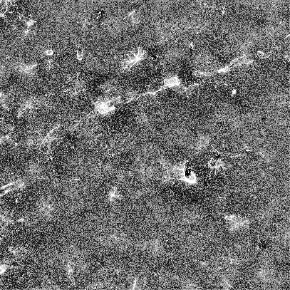 Als 208 Random3 Object Detection Dataset By Sarah Syed