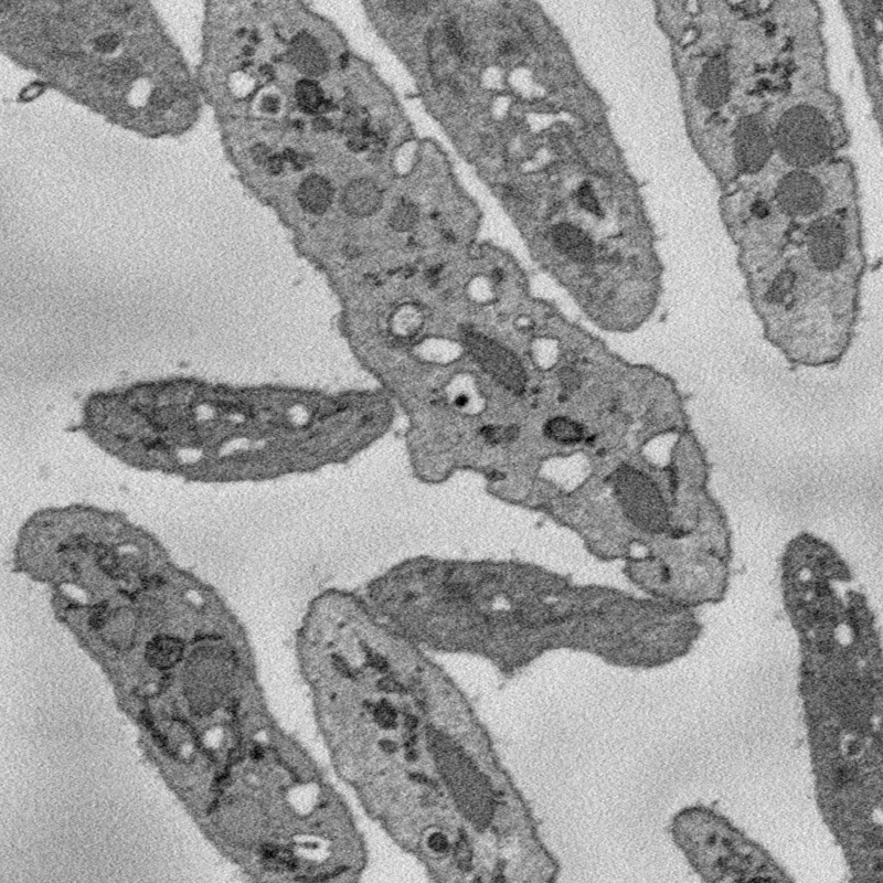 Cell Segmentation Instance Segmentation Dataset By Anl