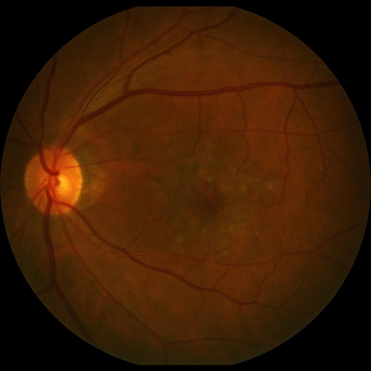 RF_T_H1 Object Detection Dataset by project1