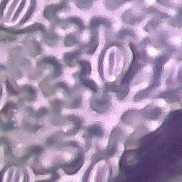 stomata cells Object Detection Dataset and Pre-Trained Model by Roboflow 100