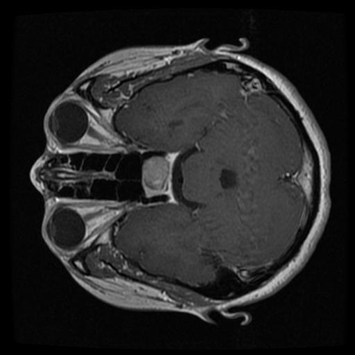 RAW AUGMENTASI Object Detection Dataset and Pre-Trained Model by Adinda ...