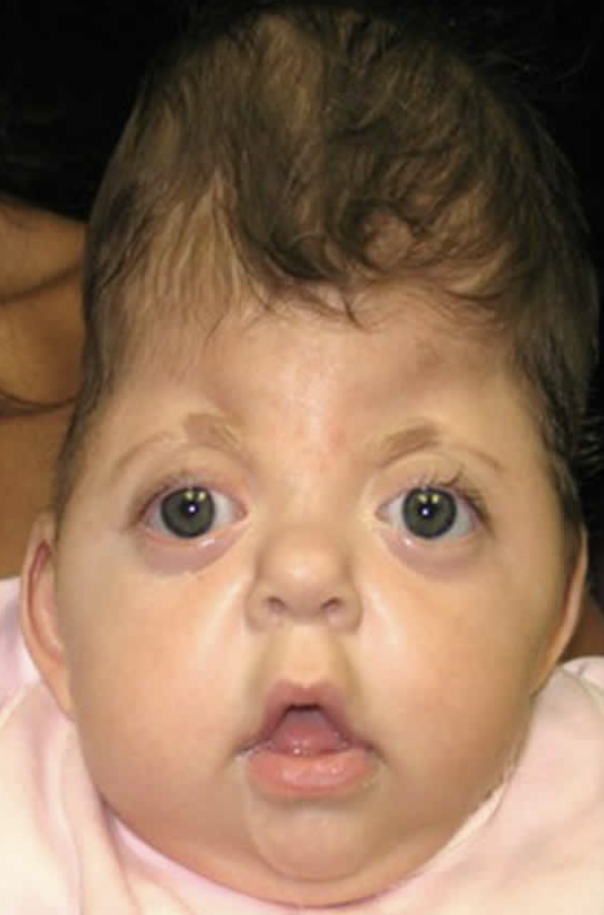 Syndromic Synostosis Classification Dataset and Pre-Trained Model by ...