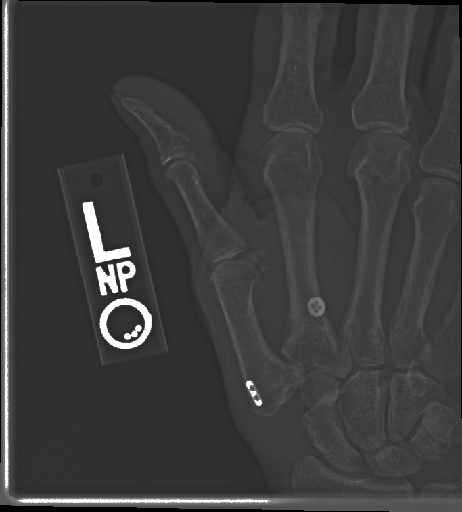 Bone_Joints_Mini Object Detection Dataset by BoneResearch Bone_Joints_Mini Object Detection Dataset by BoneResearch