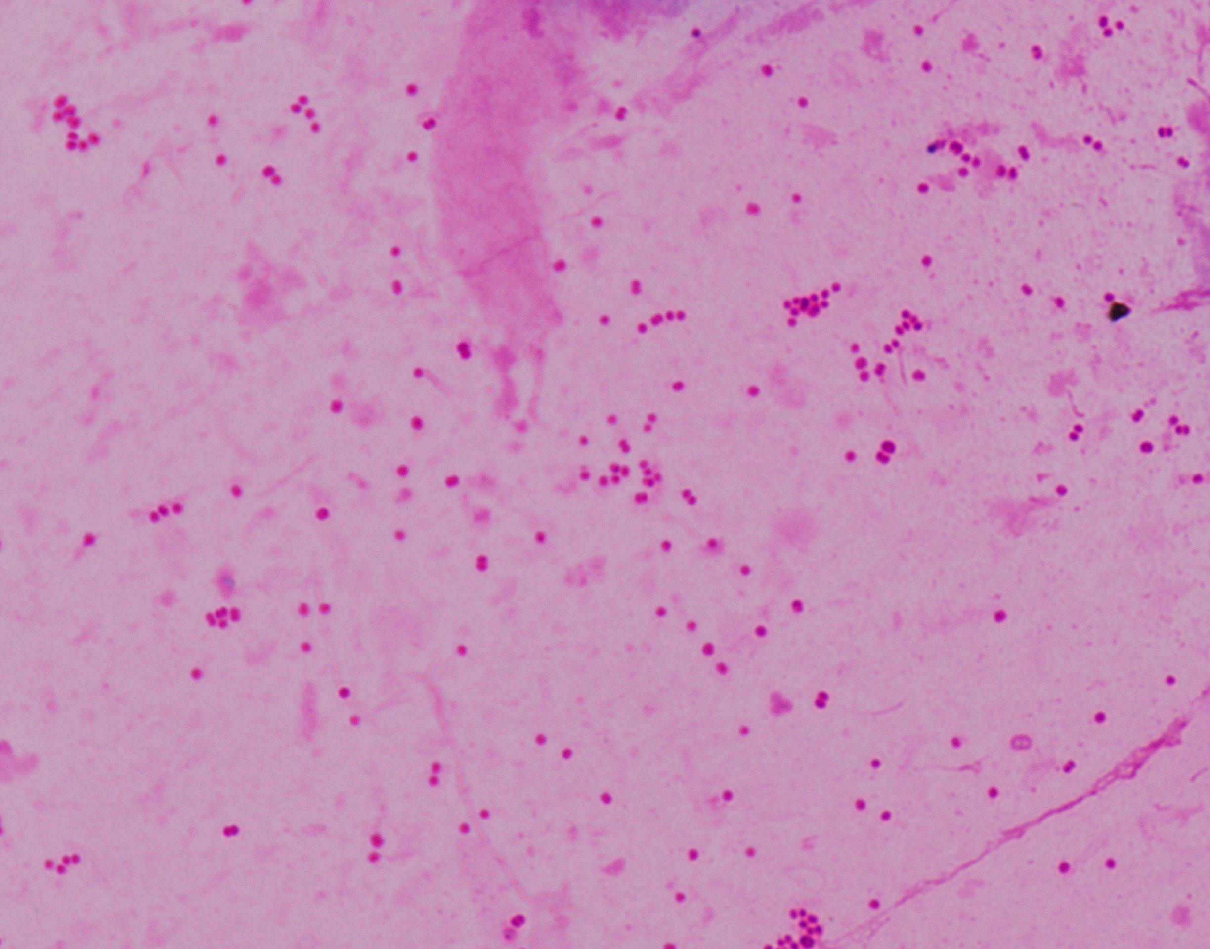 bacteria Object Detection Dataset by thirteenbacteria1