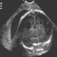 Fetal brain Instance Segmentation Dataset and Pre-Trained Model by CV
