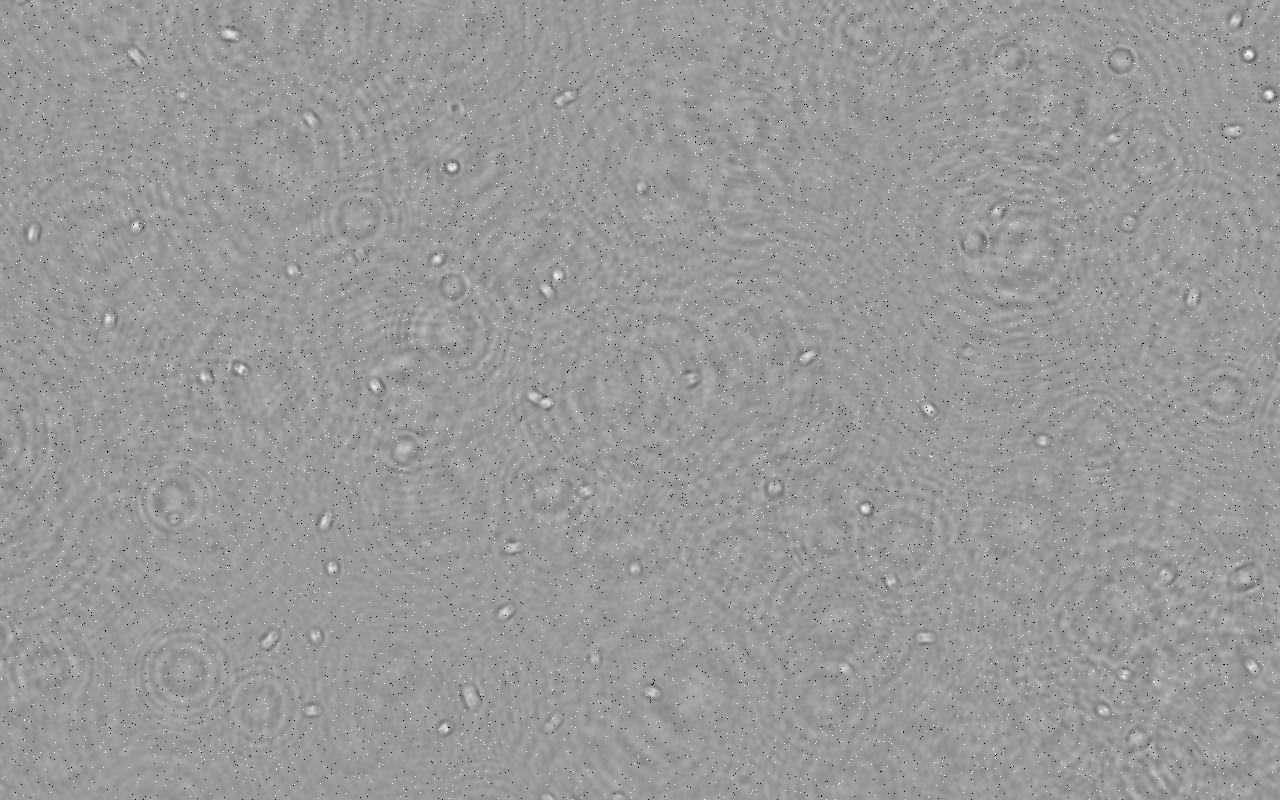 Ecoli Image Dataset Lei Feng Workspace Object Detection Dataset By