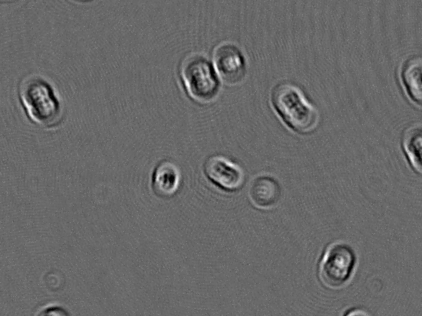 Bacterial Only Image Dataset Abha Gejji Workspace Object Detection