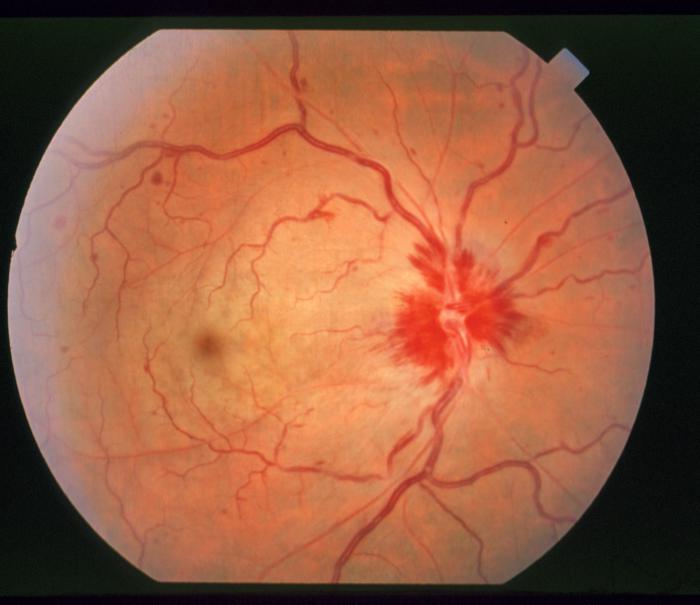 HR Classification Classification Dataset and Pre-Trained Model by ...