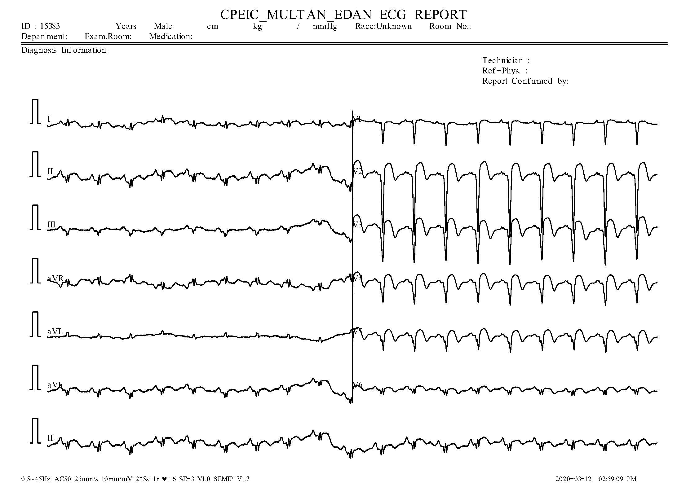 Ecg Graph Object Detection Dataset By Mm
