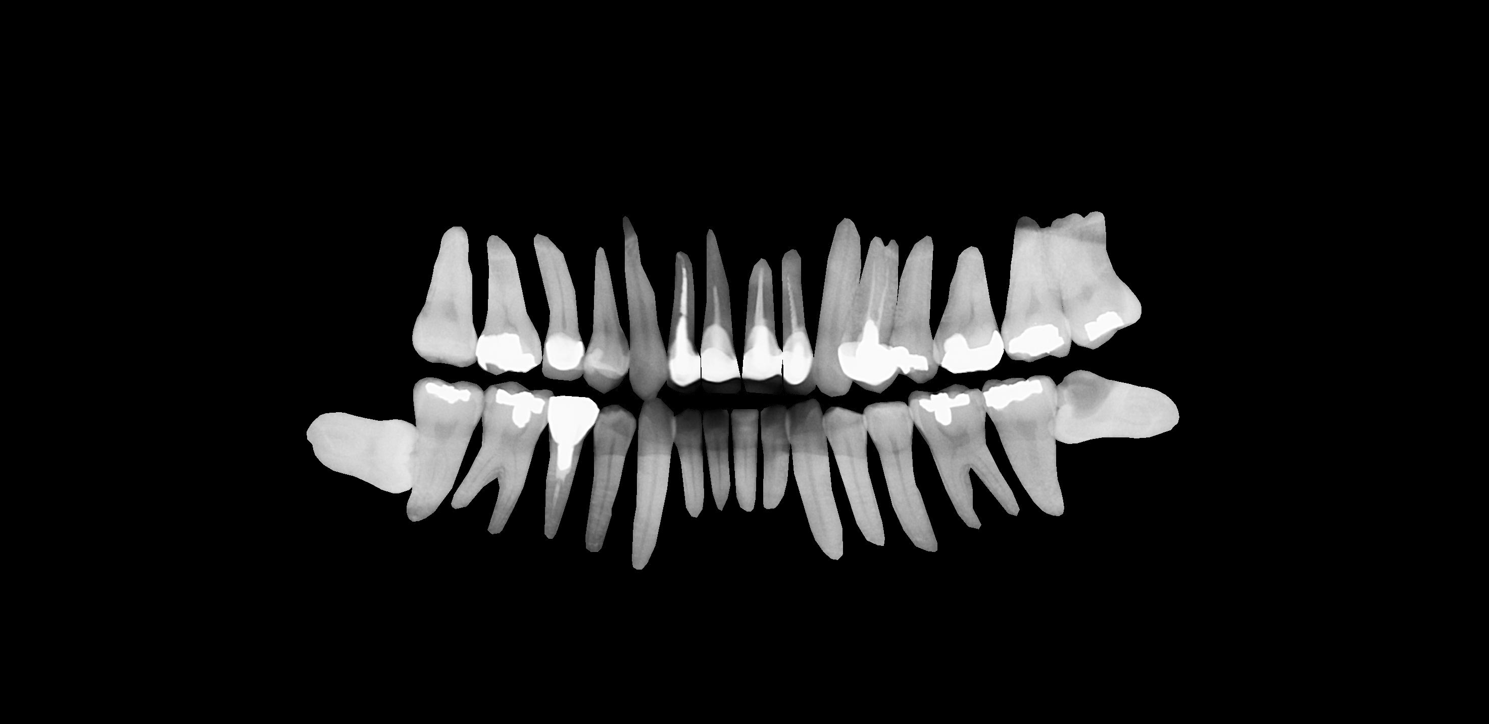 After Seg Object Detection Dataset V2 2022 11 09 12 42am By Teeth