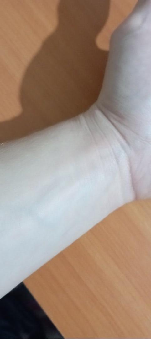 Wrist Recognition Object Detection Dataset By Istu