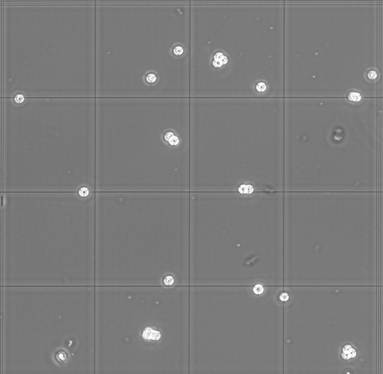 cell count master Object Detection Dataset and Pre-Trained Model by school