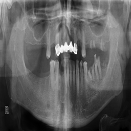 tooth classification Semantic Segmentation Dataset by school