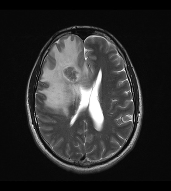 How to Use the Brain Scan MRI Object Detection API