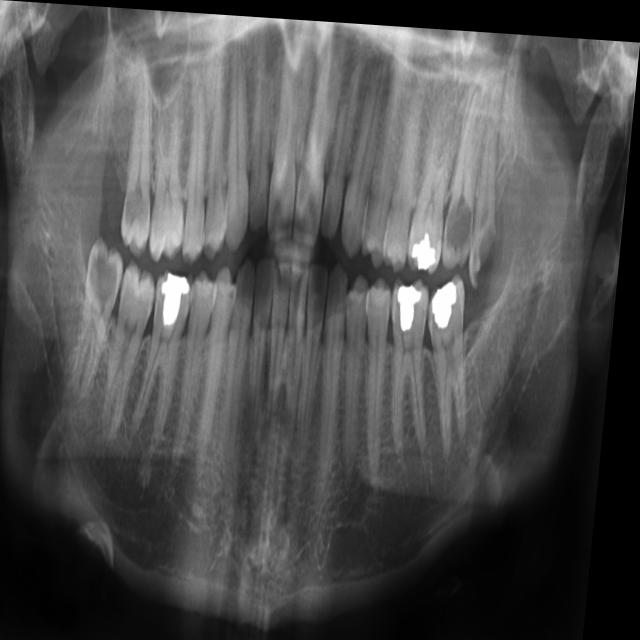 tooth Object Detection Dataset by SA