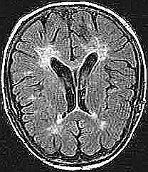 Carcinogenic Cells Object Detection Dataset by class