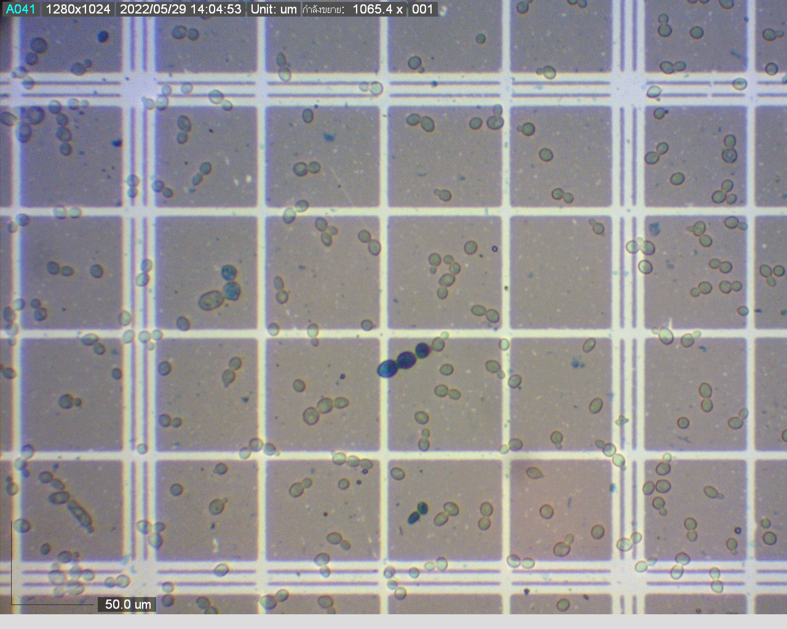 Aiml Cell Yeast Counter Roboflow Universe