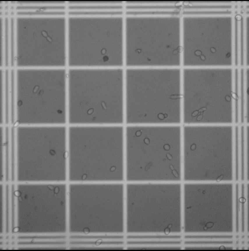 yeast - budding zone Object Detection Dataset and Pre-Trained Model by AIML Cell Yeast Counter