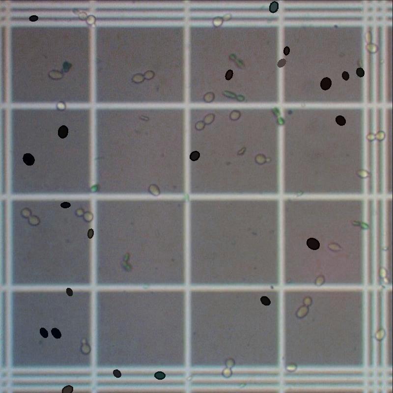 yeast-deadcell Object Detection Dataset and Pre-Trained Model by AIML ...