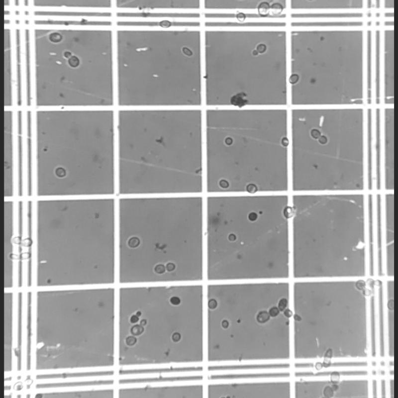 Yeast - box area Object Detection Dataset and Pre-Trained Model by AIML Cell Yeast Counter
