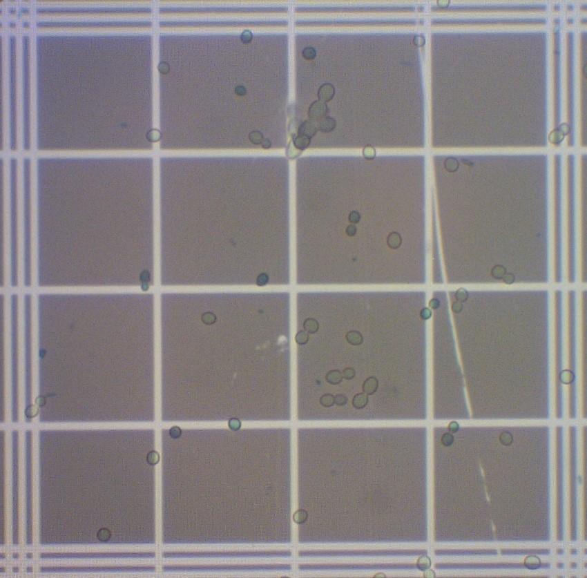 yeast infected cell - detect Object Detection Dataset and Pre-Trained Model by AIML Cell Yeast ...