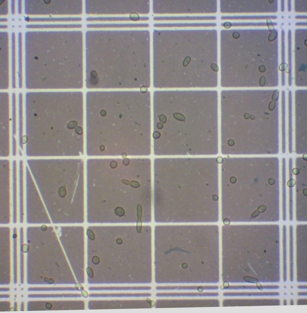 How To Use The Yeast Cell Counting V2 Object Detection Api