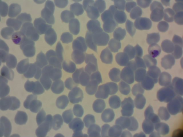 RBC MALARIA Instance Segmentation Dataset and Pre-Trained Model by ...