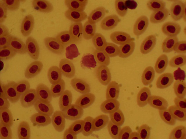 Chicken_Cells Object Detection Dataset by DaniloPereira