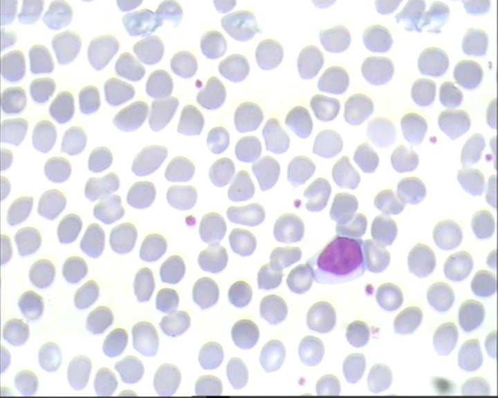 LISC_WBC types Object Detection Dataset by pfmannion